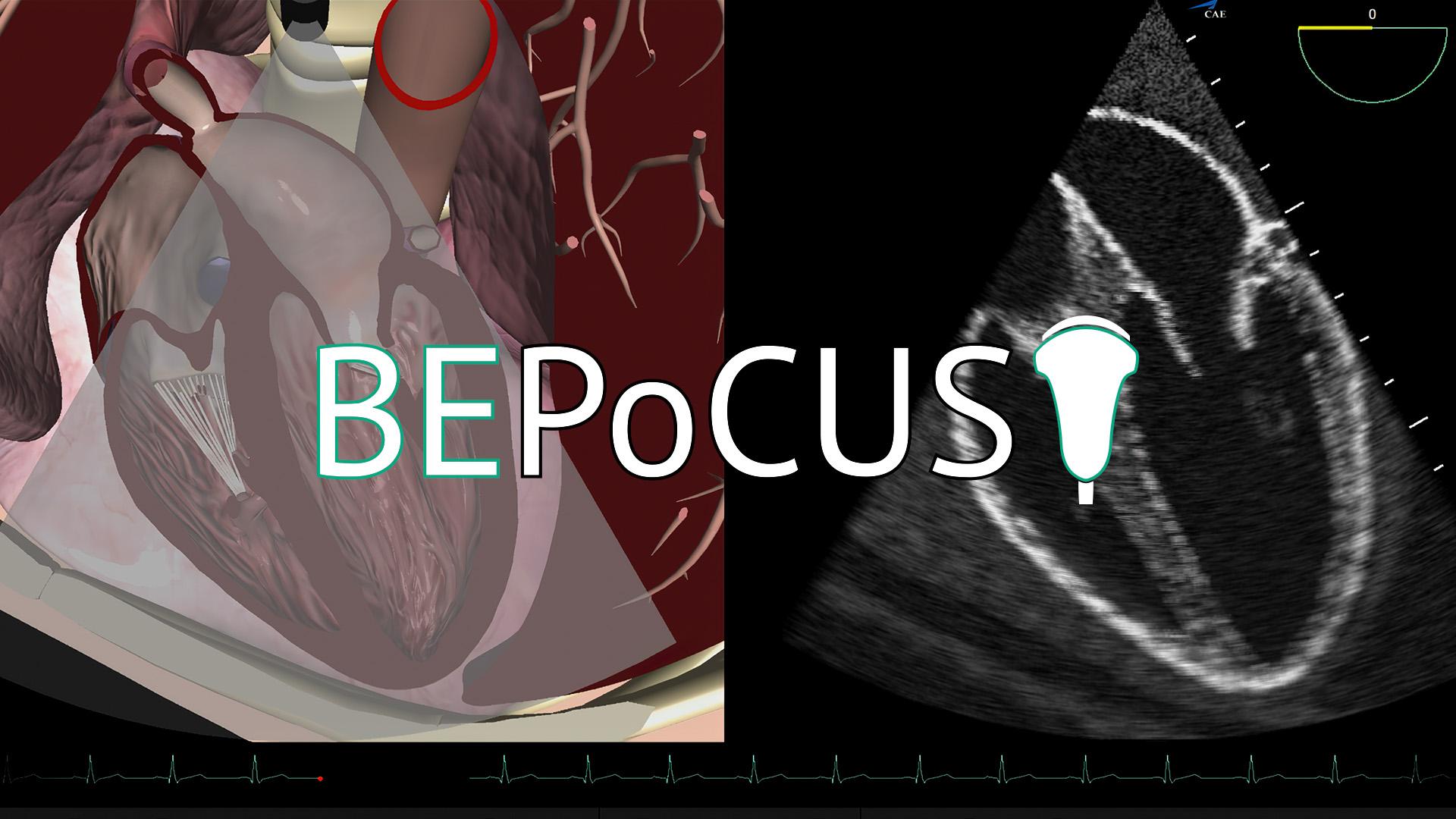 Curriculum in Point-of-Care UltraSound